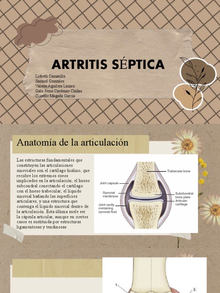 Artritis Séptica en Potros | PDF