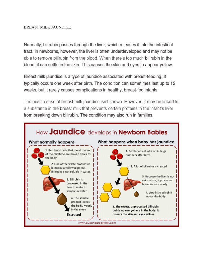 Newborn Breast Milk Jaundice Guide | PDF | Wellness