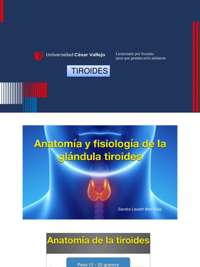 TIROIDES | PDF | Hipertiroidismo | Tiroides
