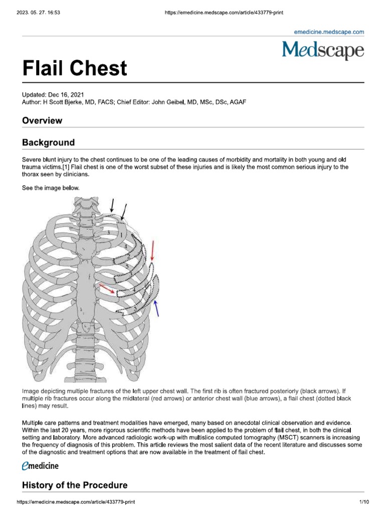 Flail Chest | PDF
