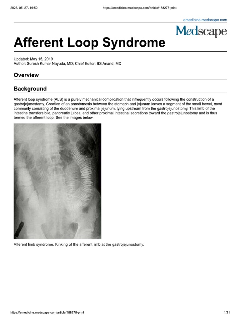 Afferent Loop Syndrome | PDF