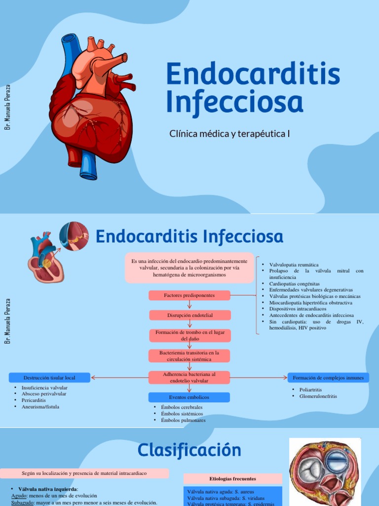 5 Endocarditis Infecciosa MI | PDF