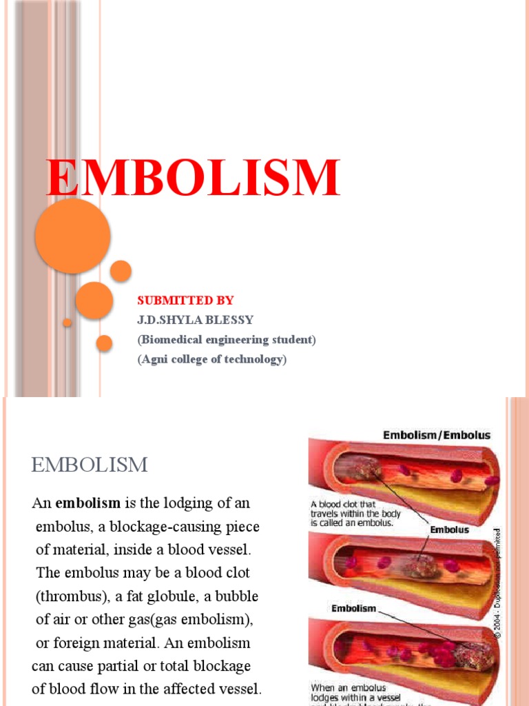 EMBOLISM 8763392 Powerpoint | PDF