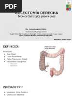 Cirugia de Hartmann | PDF | Cáncer colonrectal | Cirugía