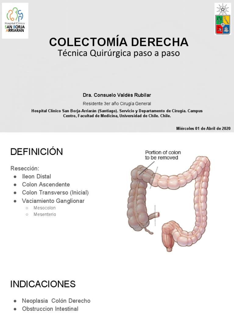 Colectomia Derecha | PDF