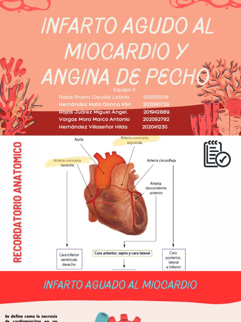 Infarto Agudoal Miocardio y Angina de Pecho | PDF