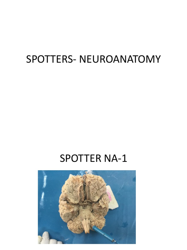 6.neuroanatomy Gross Spotters | PDF