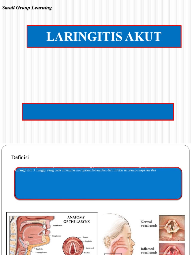 Laringitis Akut | PDF