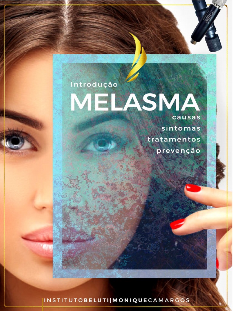 E-Book - Melasma | PDF