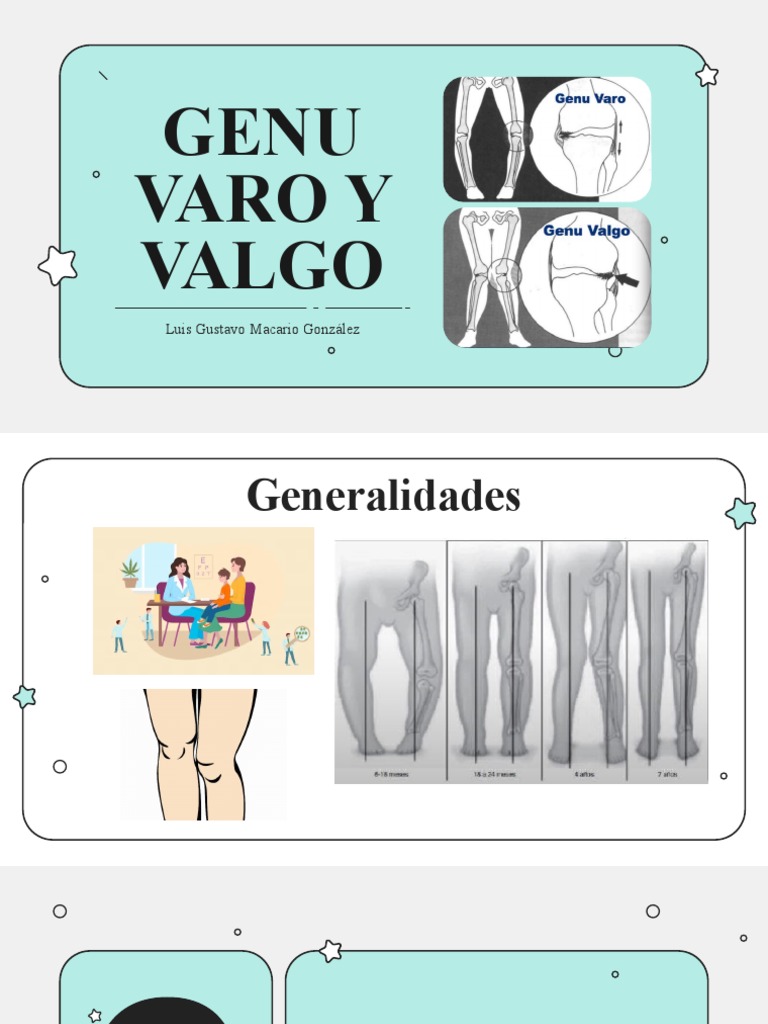 Varo y Valgo | PDF | Rodilla | Anatomía del miembro inferior