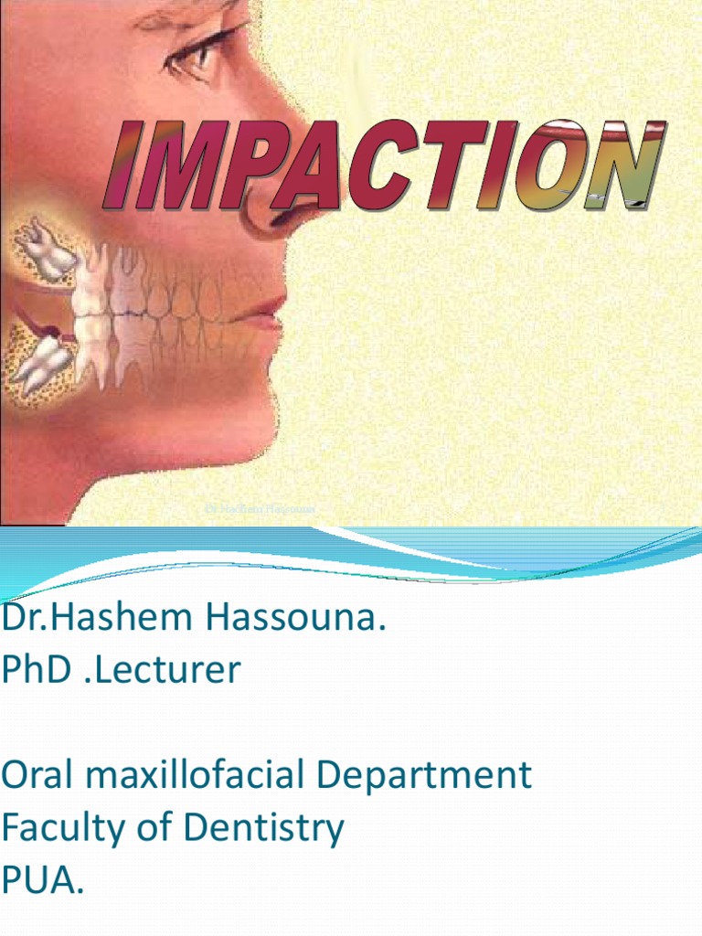Impaction 1 | PDF