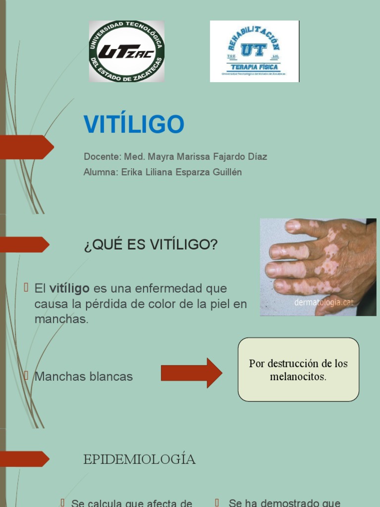 VITÍLIGO | PDF