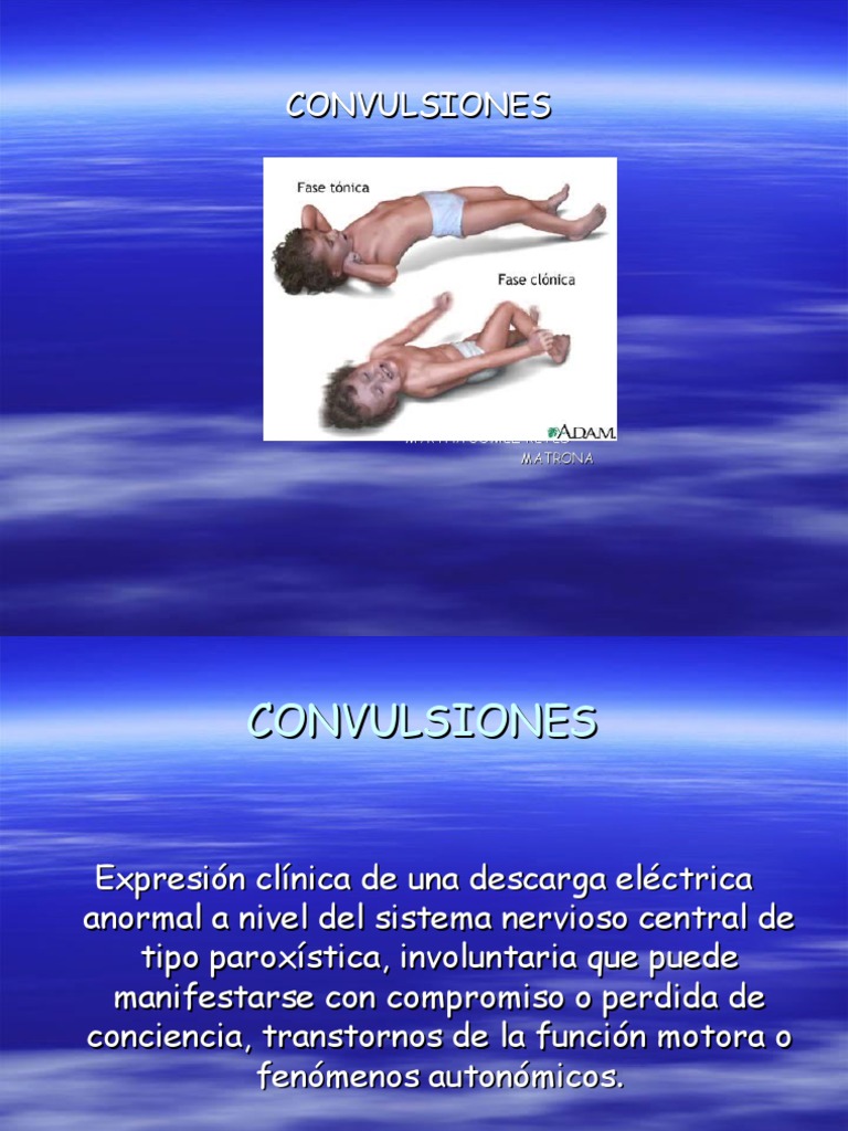 Convulsiones | PDF | Especialidades Medicas | Síntomas y signos