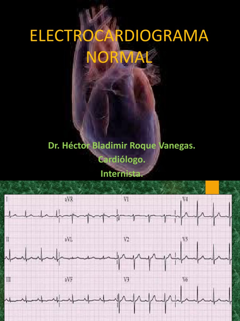 ECG Normal-1 | PDF | Electrocardiografia | Imagenes medicas