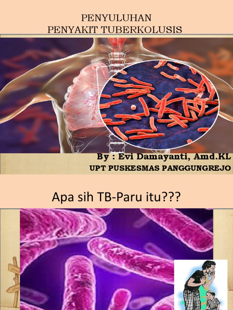 Pencegahan dan Penularan TB-Paru | PDF