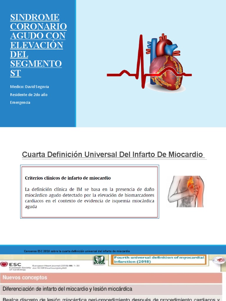 Sindrome Coronario Agudo Con Elevación Del Segmento ST | PDF | Infarto de miocardio | Angiología