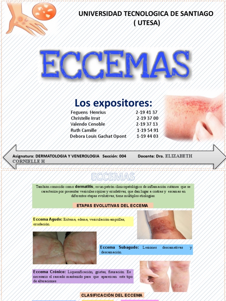 eccemas-o-dermatitis | PDF