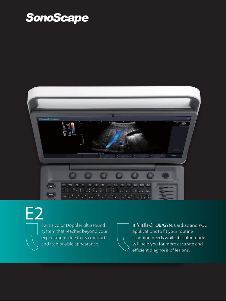 Brochure Sonoscape | PDF