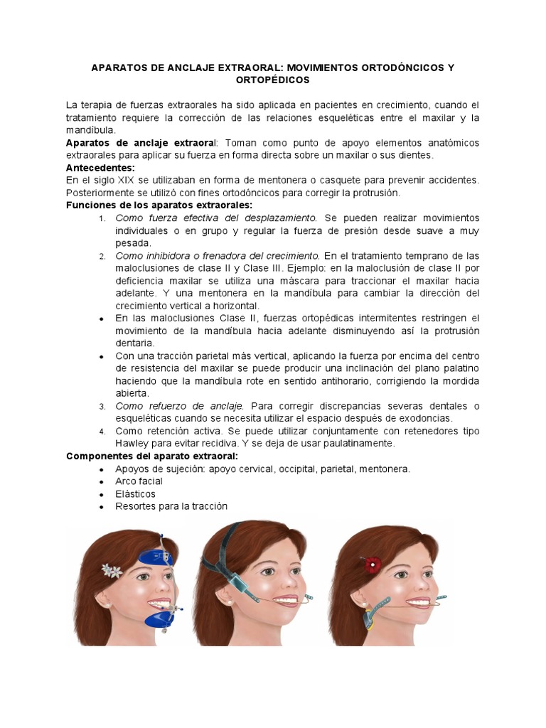 Aparatos de Anclaje Extraoral | PDF
