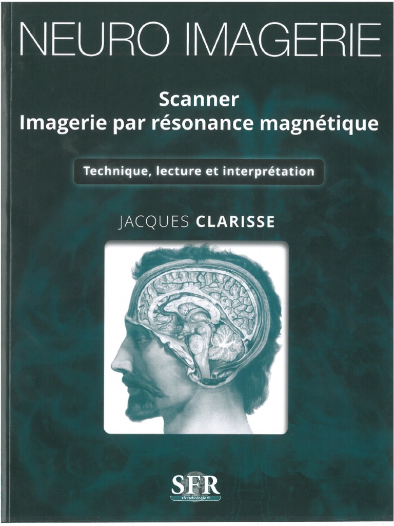 Neuro Imagerie Scanner Irm SFR | PDF