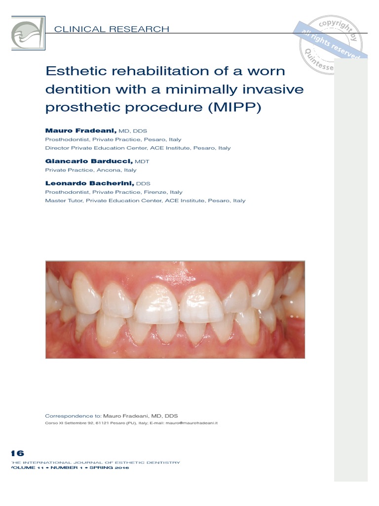 Esthetic Rehabilitation of A Worn Dentition With A Minimally Invasive ...