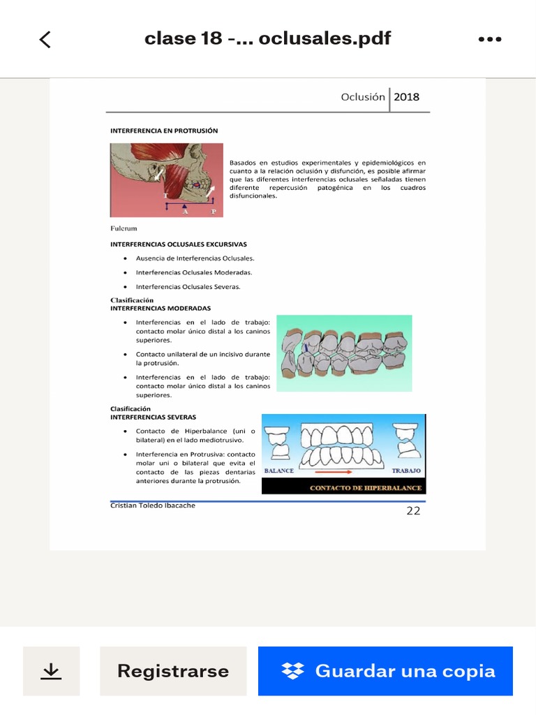 Oclusion - Interferencias oclusales.pdf | PDF | Anatomia dental | Diente