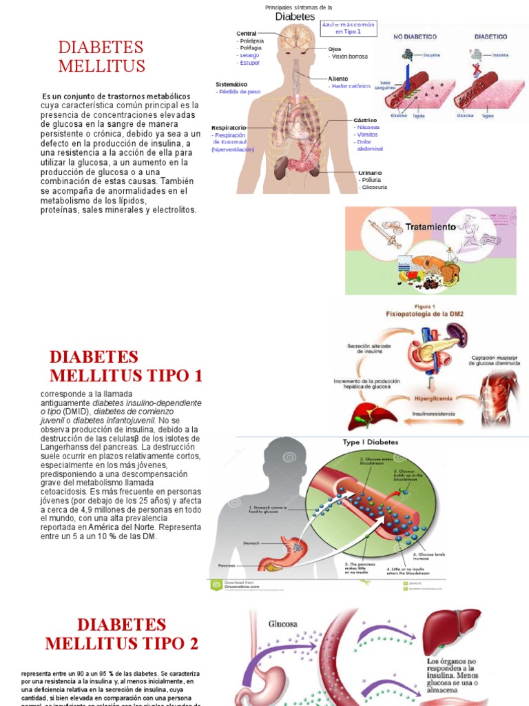 Diabetes Mellitus | PDF | Diabetes | Sistema endocrino