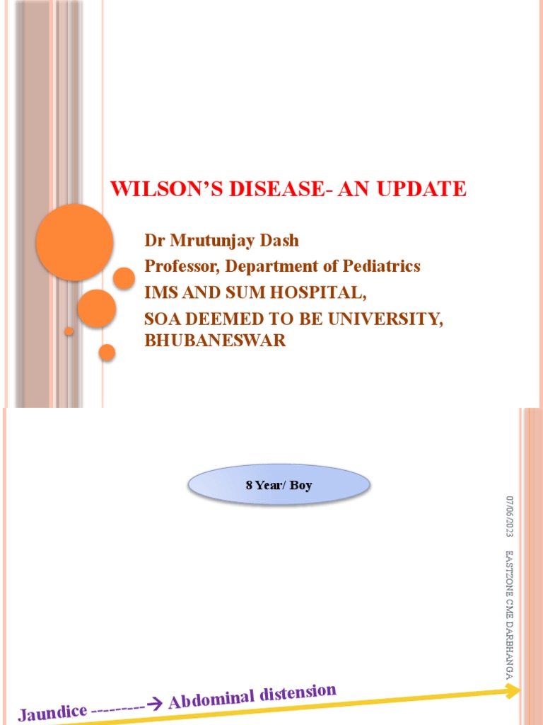 Wilson's Disease | PDF | Alanine Transaminase | Cirrhosis