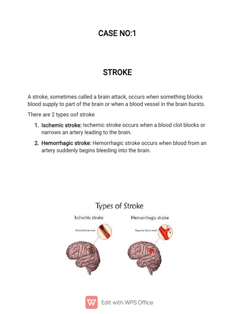 Stroke PDF | PDF | Stroke | Physical Therapy
