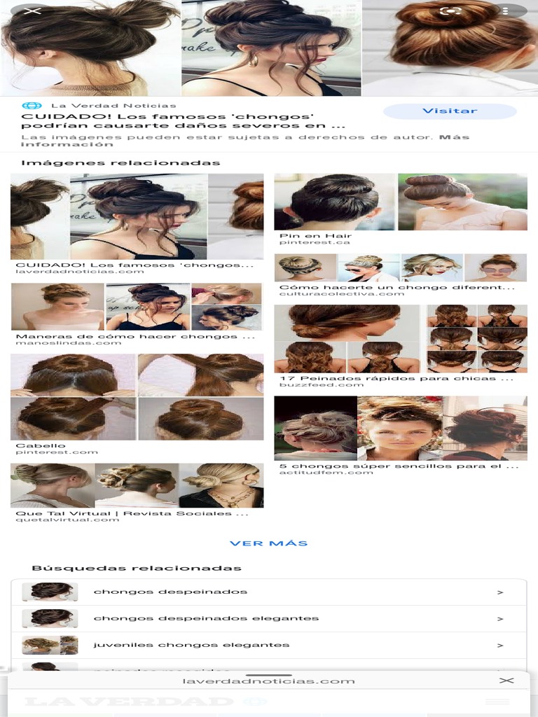 Peligros de los Chongos en el Cabello | PDF