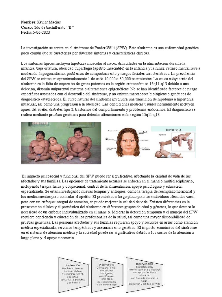 Xavier Macias Montalvo - Investigación - Síndrome de Prader Willis ...