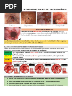 Protocolo Sydney y Estadificacion Olga | PDF | Cáncer | Atrofia