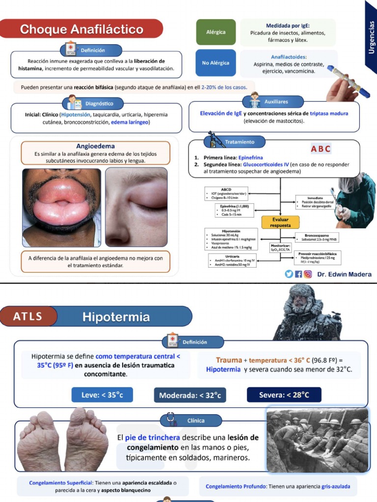 Atls Edwin Madera Flash Card | PDF