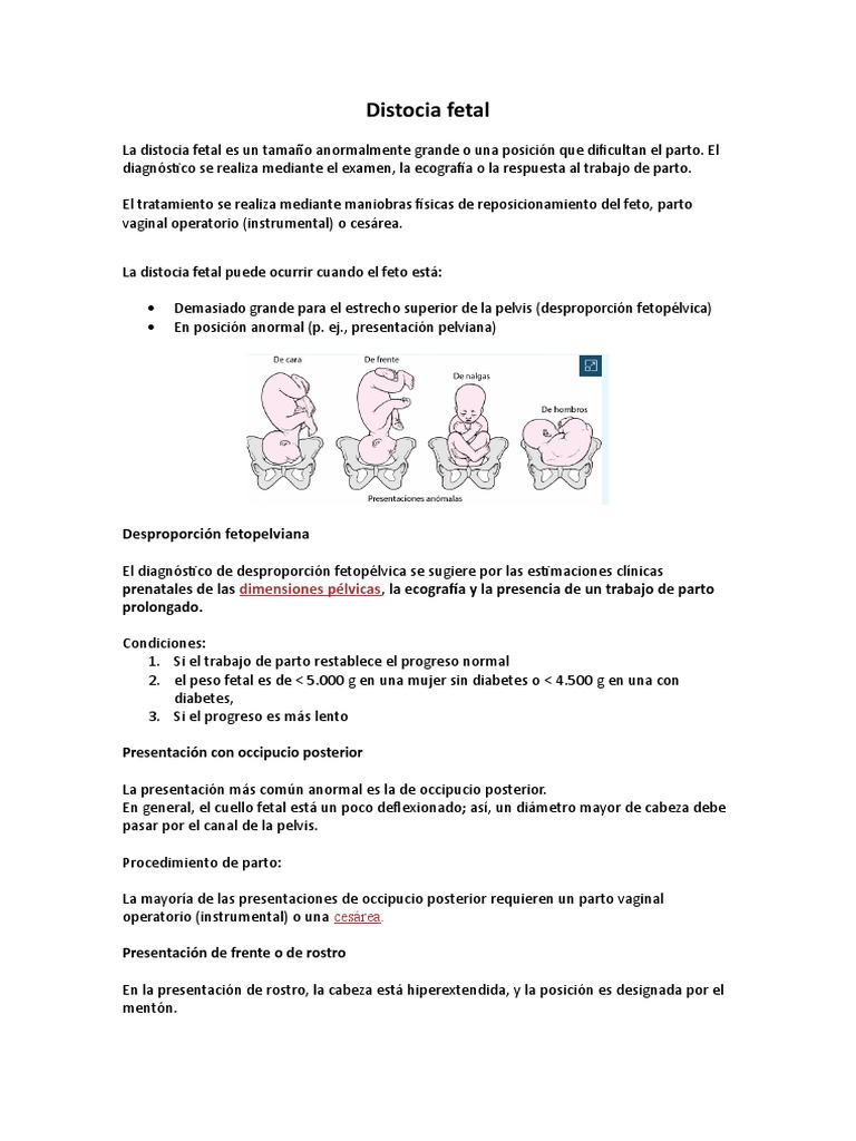 Distocia Fetal | PDF | Parto | Ciencias de la Salud