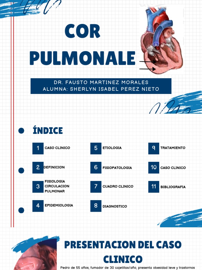 Cor Pulmonale | Descargar gratis PDF | Órgano (anatomía) | Medicina CLINICA