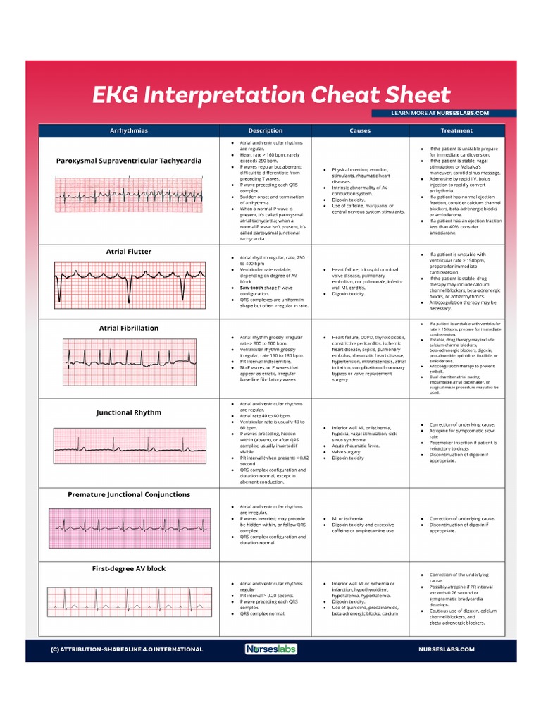 EKG Interpretation Cheat Sheet For Heart Arrhythmias Nurseslabs 2 | PDF