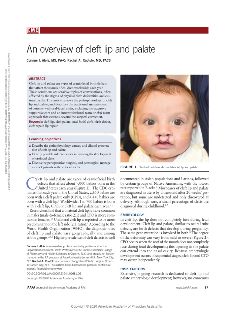 An Overview of Cleft Lip and Palate.3 | PDF