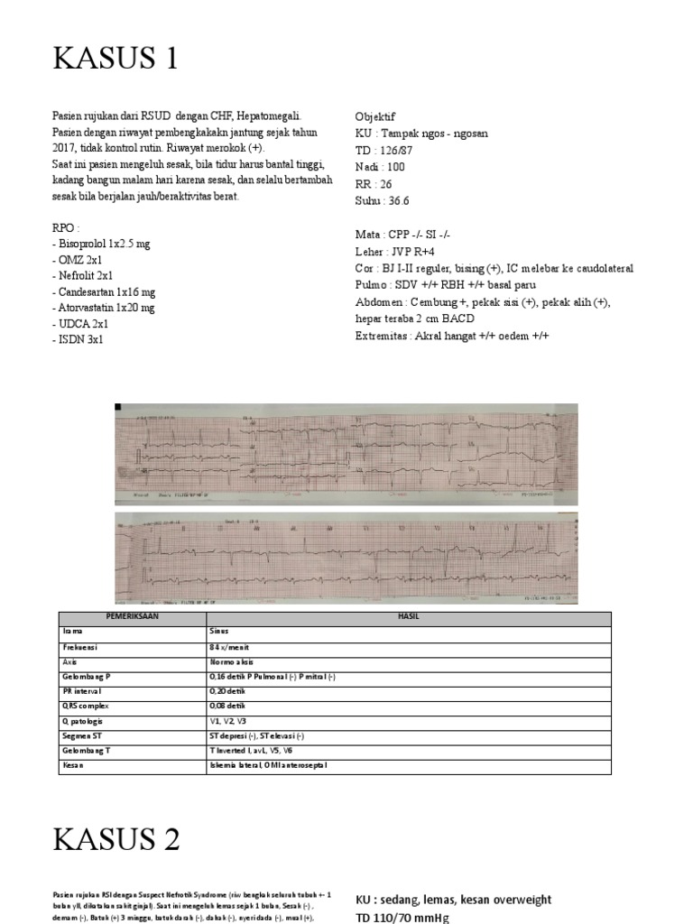Kasus EKG-1 | PDF
