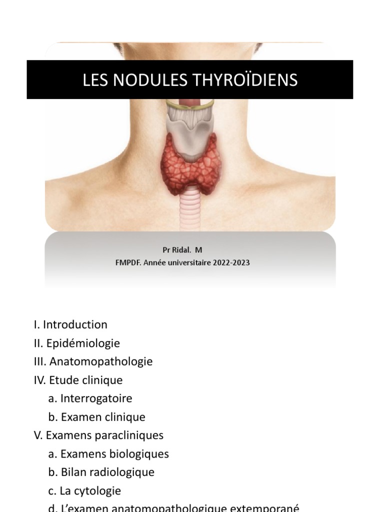 Les Nodules Thyroïdiens | PDF | Thyroïde | Hyperthyroïdie