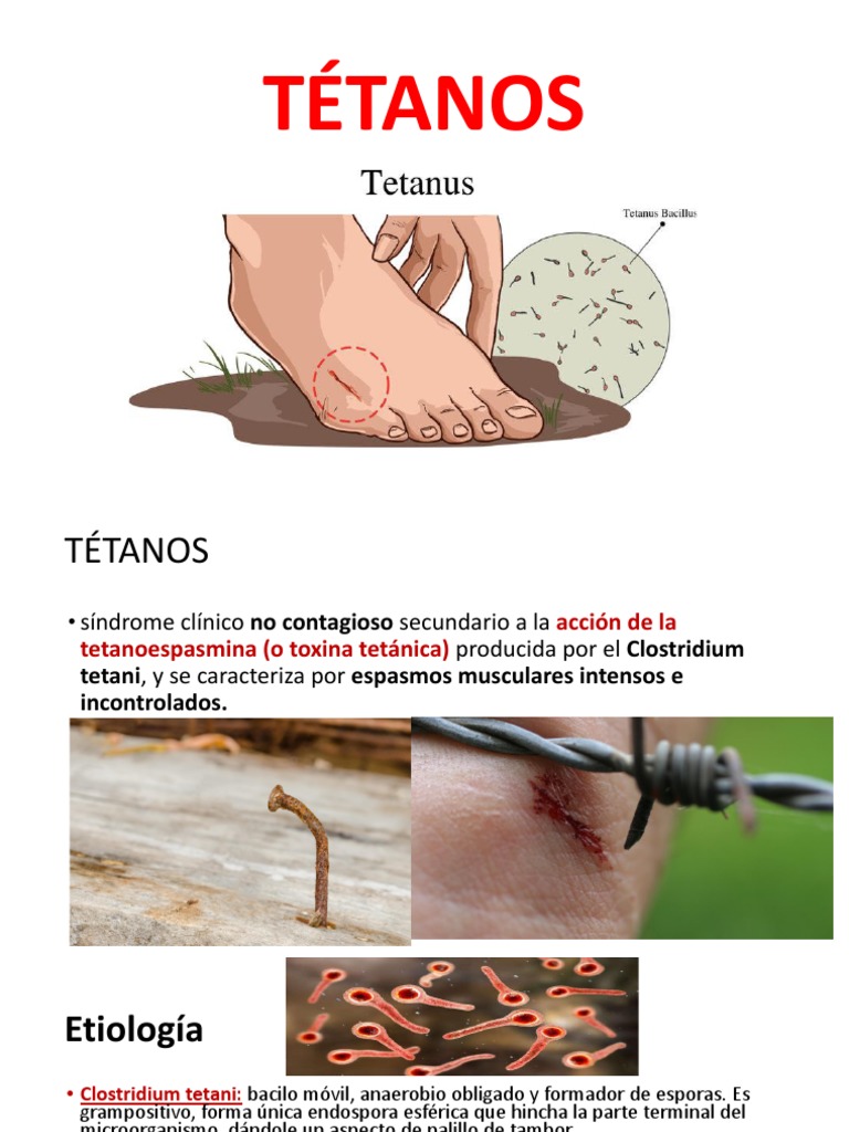 Tetanos | PDF | Medicina | Medicina CLINICA