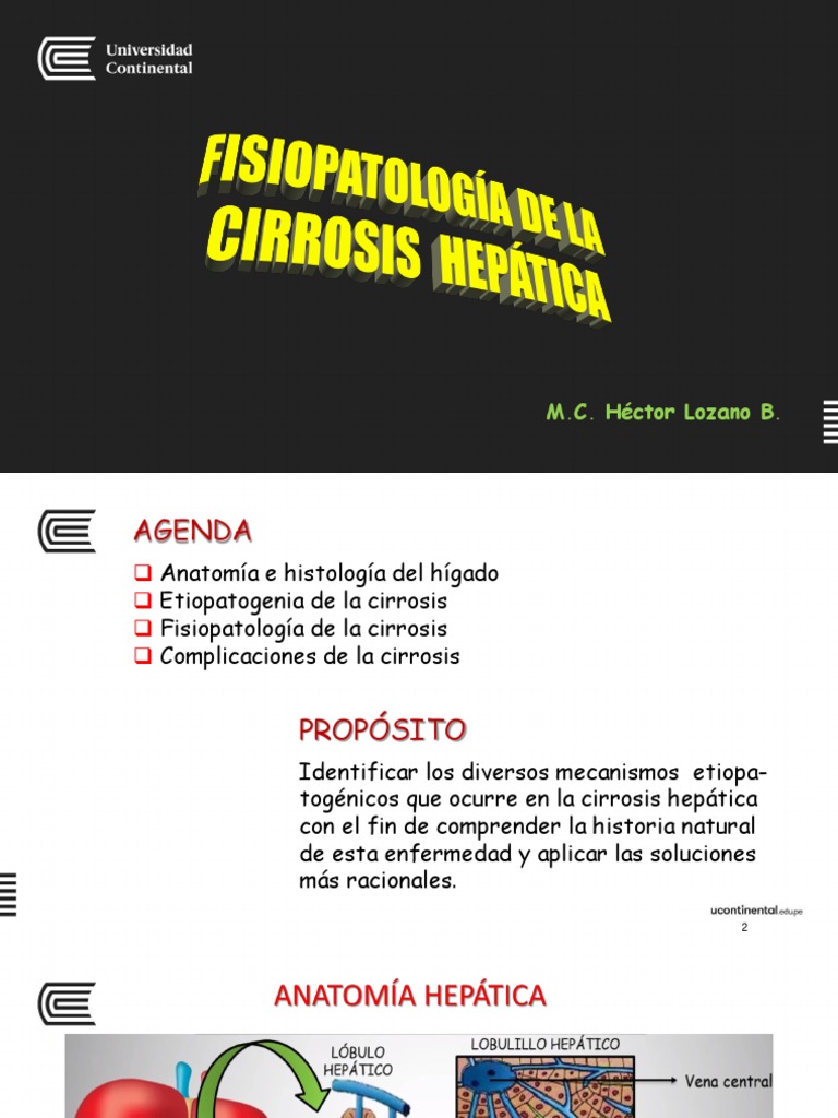 Fisiopatología de la Cirrosis | PDF | Cirrosis | Hígado