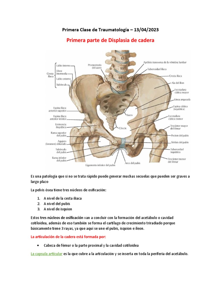 Displasia de Cadera | PDF | Articulación | Pelvis