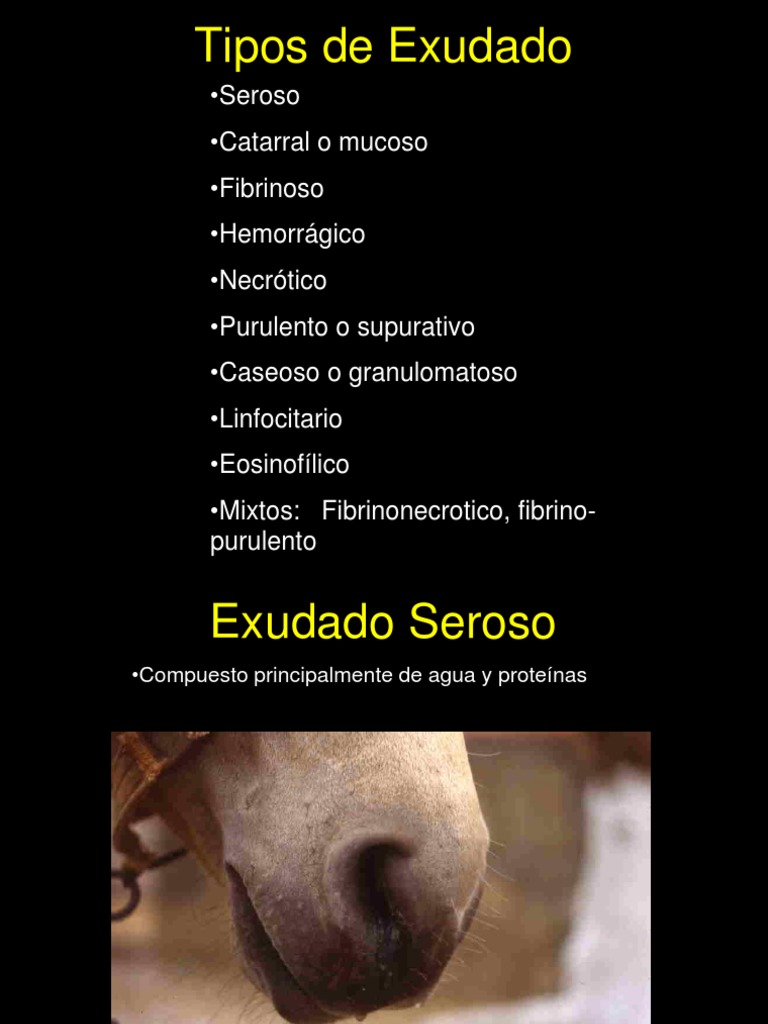 II Tipos de Exudado | PDF