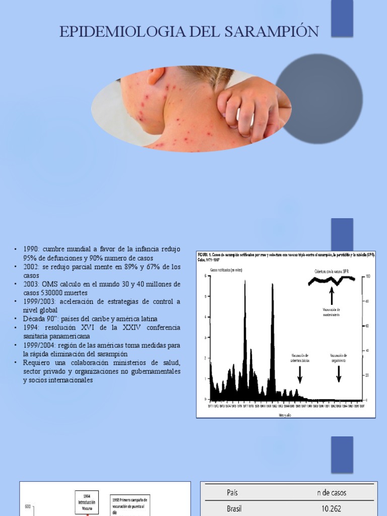 Epidemiologia Del Sarampión | PDF | Sarampión | Virus