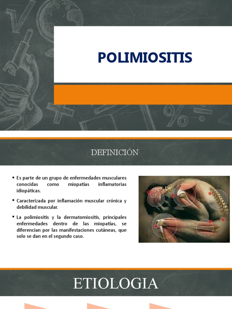 POLIMIOSITIS ; | PDF | Inmunología | Ciencias de la Salud