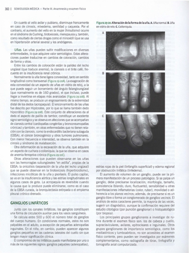 Goic Semiologia 361 - 390 | PDF | Legumbres | Alergia