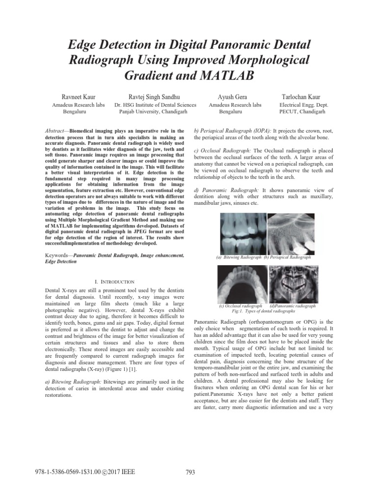 2017 - Edge Detection in Digital Panoramic Dental Radiograph Using Improved Morphological ...