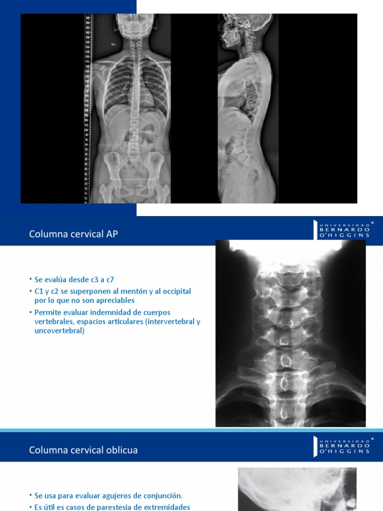 Imagen Rx 8 - Columna | PDF | La columna vertebral | Vértebra
