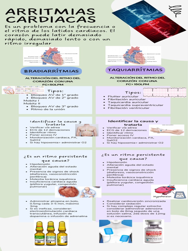 Arritmias Cardiacas | PDF | Arritmia cardiaca | Electrofisiología cardíaca