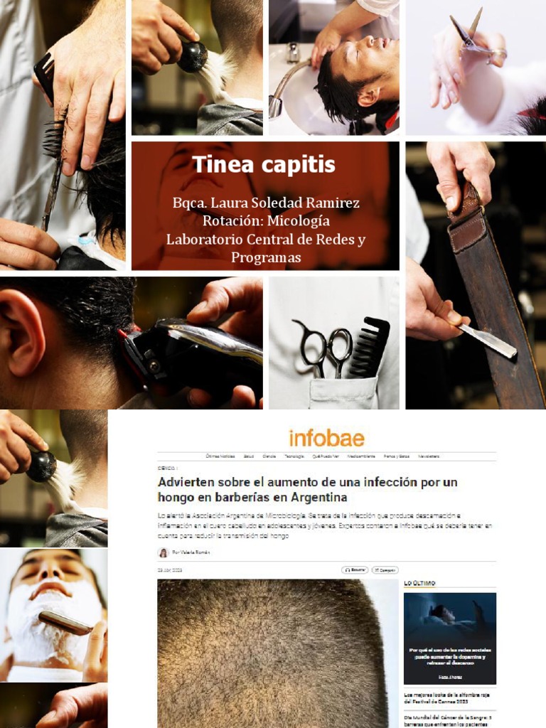 Tinea Capitis | PDF | Ciencias de la Salud | Dermatología
